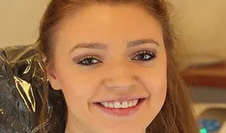 Before & After - Diley Ridge Dental